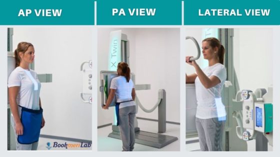 Chest X Ray Price - Book Online at Top Radiology Centers