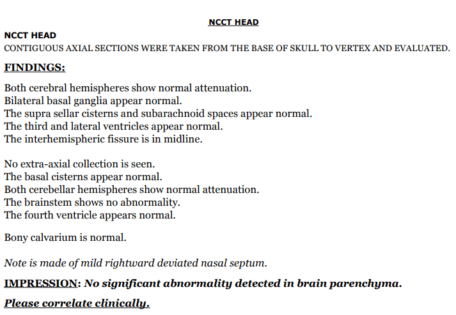 CT Scan Brain – Price, Purpose, Preparation & Results
