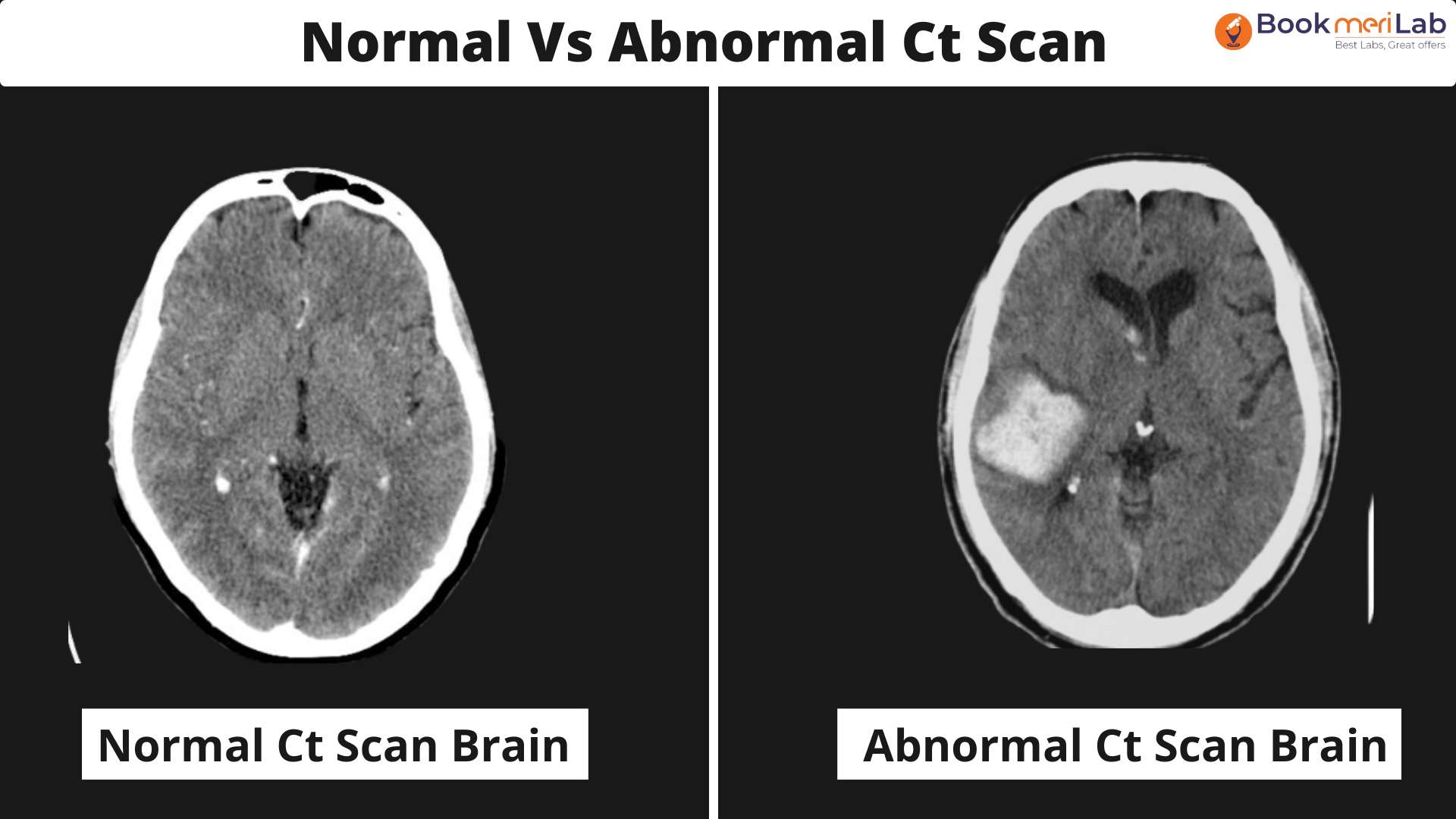 CT Scan Brain Purpose Results Cost 2023 Bookmerilab CT Scan Brain Purpose Results Cost 2023 Bookmerilab