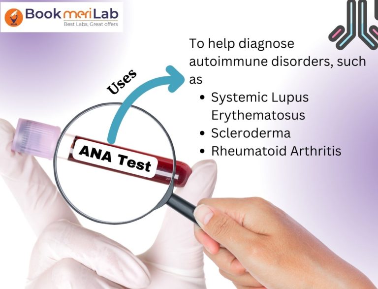 ANA Test: Purpose, Price, Procedure & Results [2025] • Bookmerilab