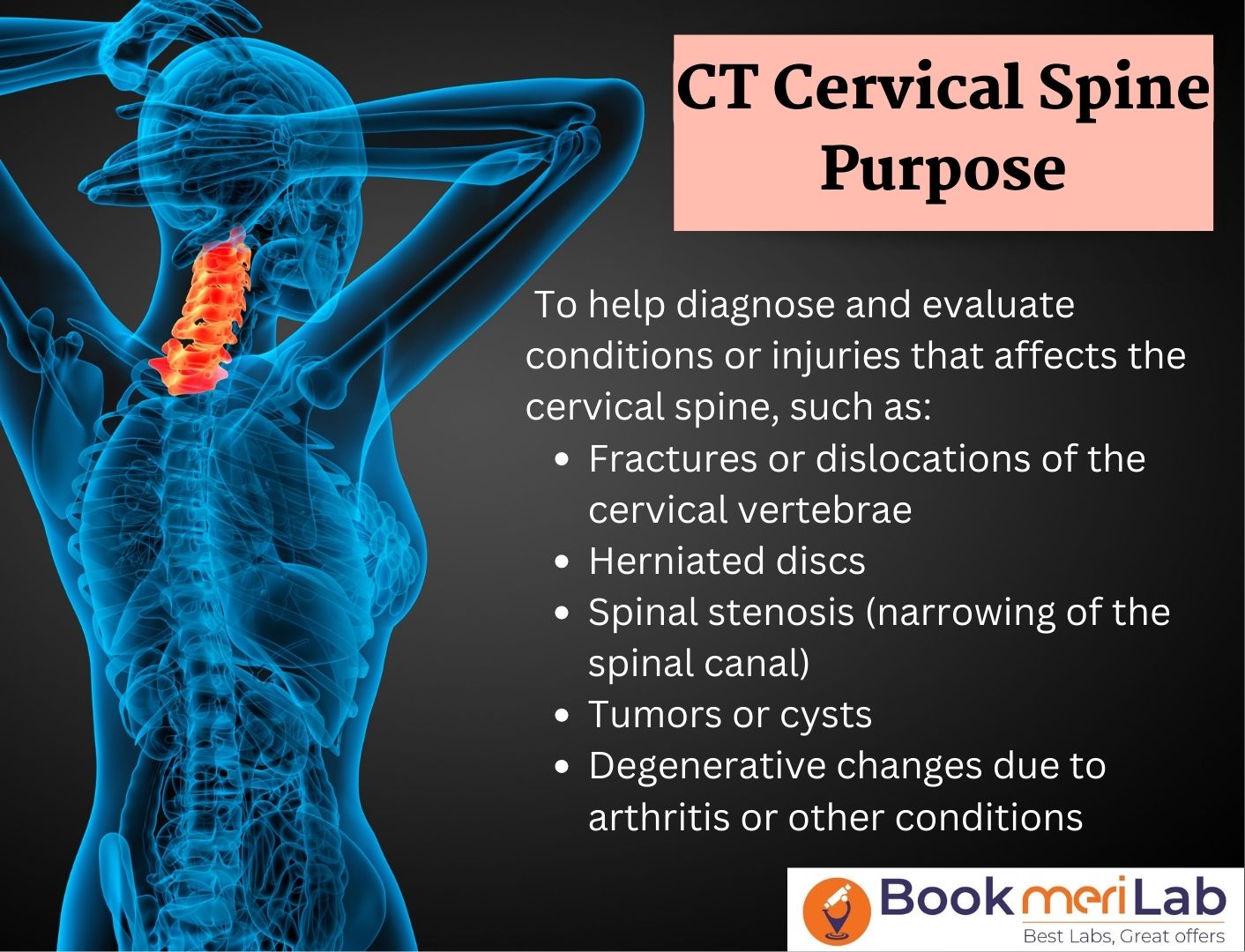 CT Cervical Spine Scan Cost Purpose Result 2024 CT Cervical Spine Scan Cost Purpose Result 2024
