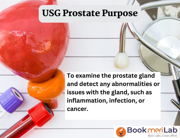 USG Prostate Price - Book Online at Top Radiology Centers