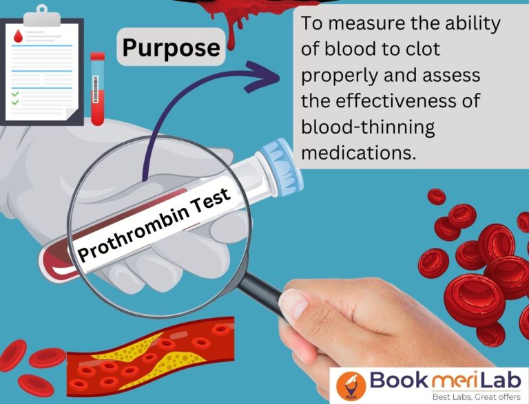 PT Test (Prothrombin Time): Price, Purpose & Result [2026]