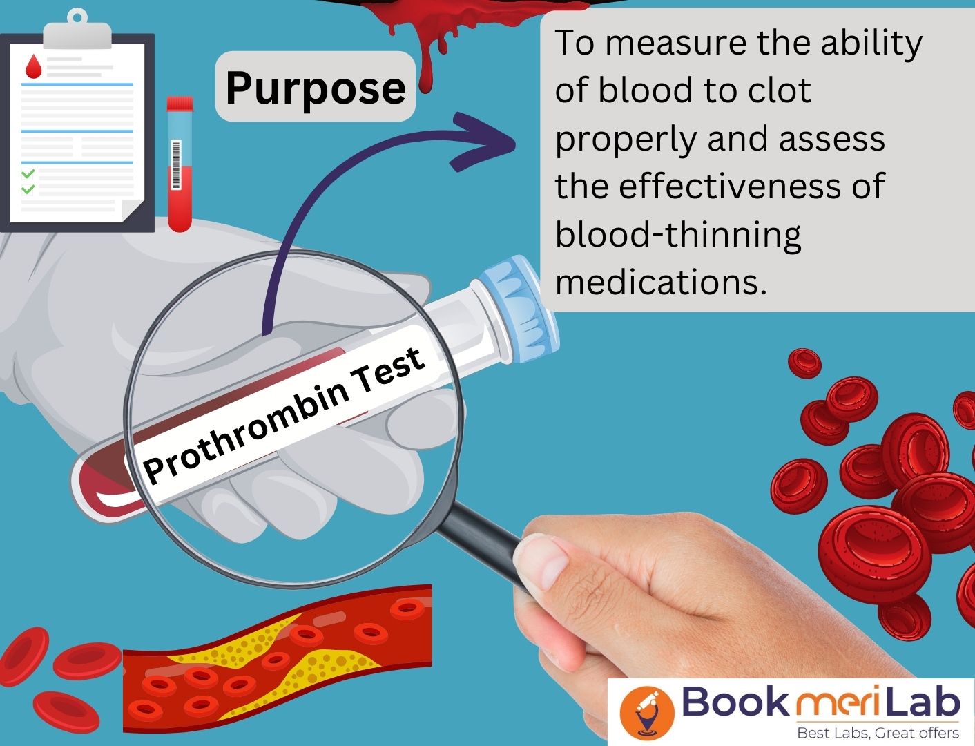 PT PTT And INR Blood Tests Purpose And Normal Ranges 45 OFF PT PTT And INR Blood Tests Purpose And Normal Ranges 45 OFF