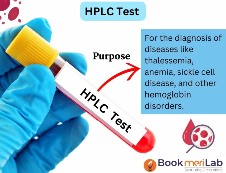 HPLC Test - Price, Purpose, Procedure & Results [2026]